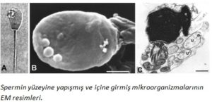 Prof. Dr. Kaan Aydos » SPERM ENFEKSİYONLARI